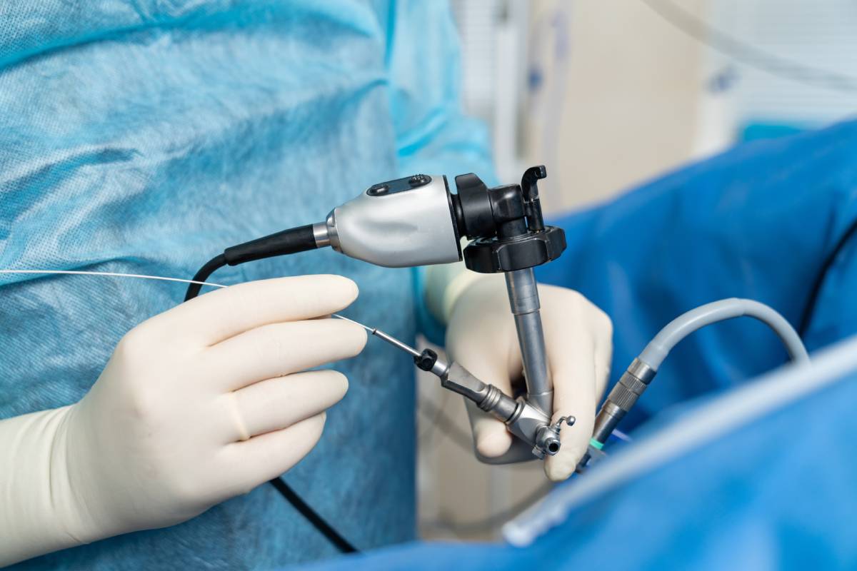 Types Of Surgical Ablation Mississippi Anesthesia Professionals